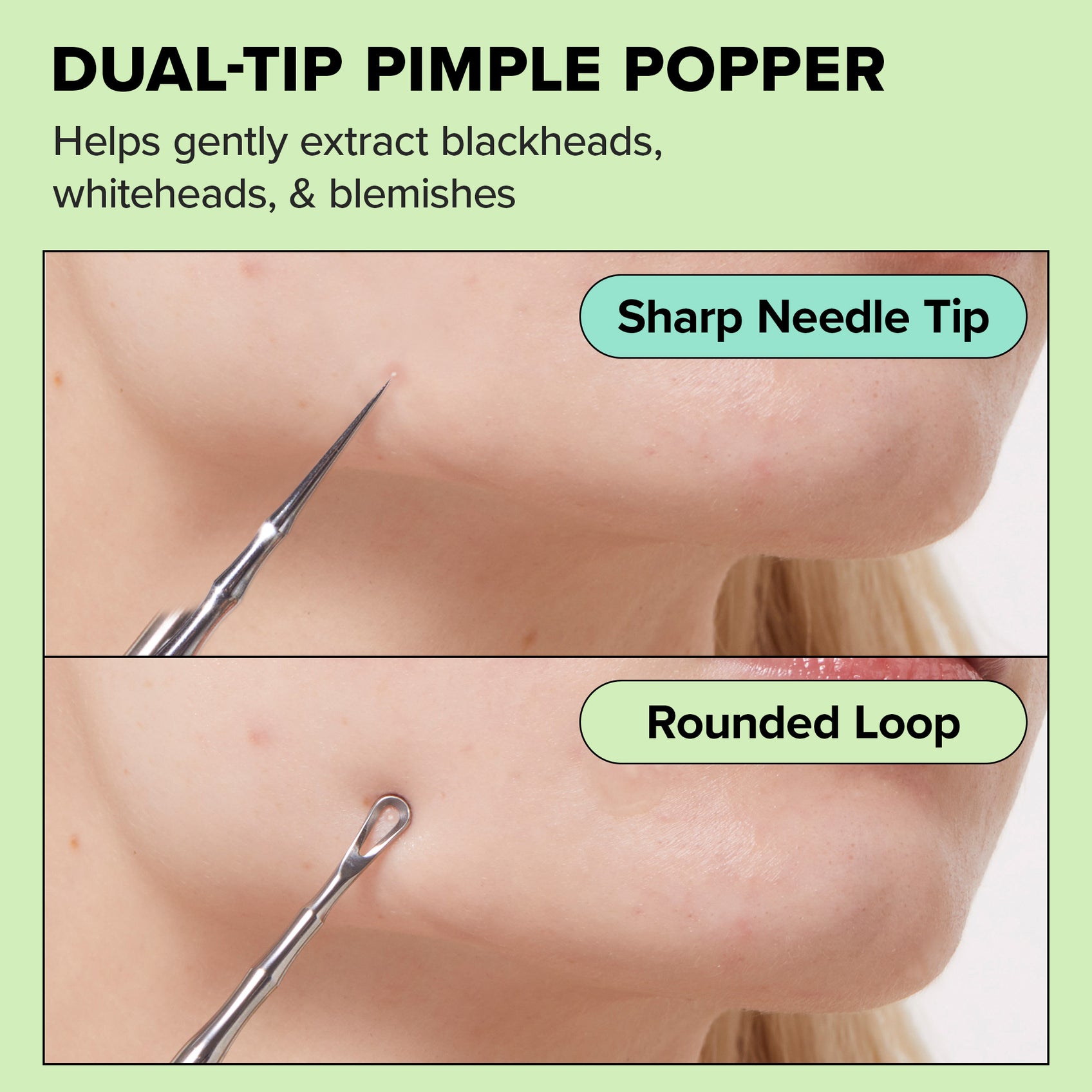 I DEW CARE | Proper Popper | Double-Ended Blemish Extractor Tool