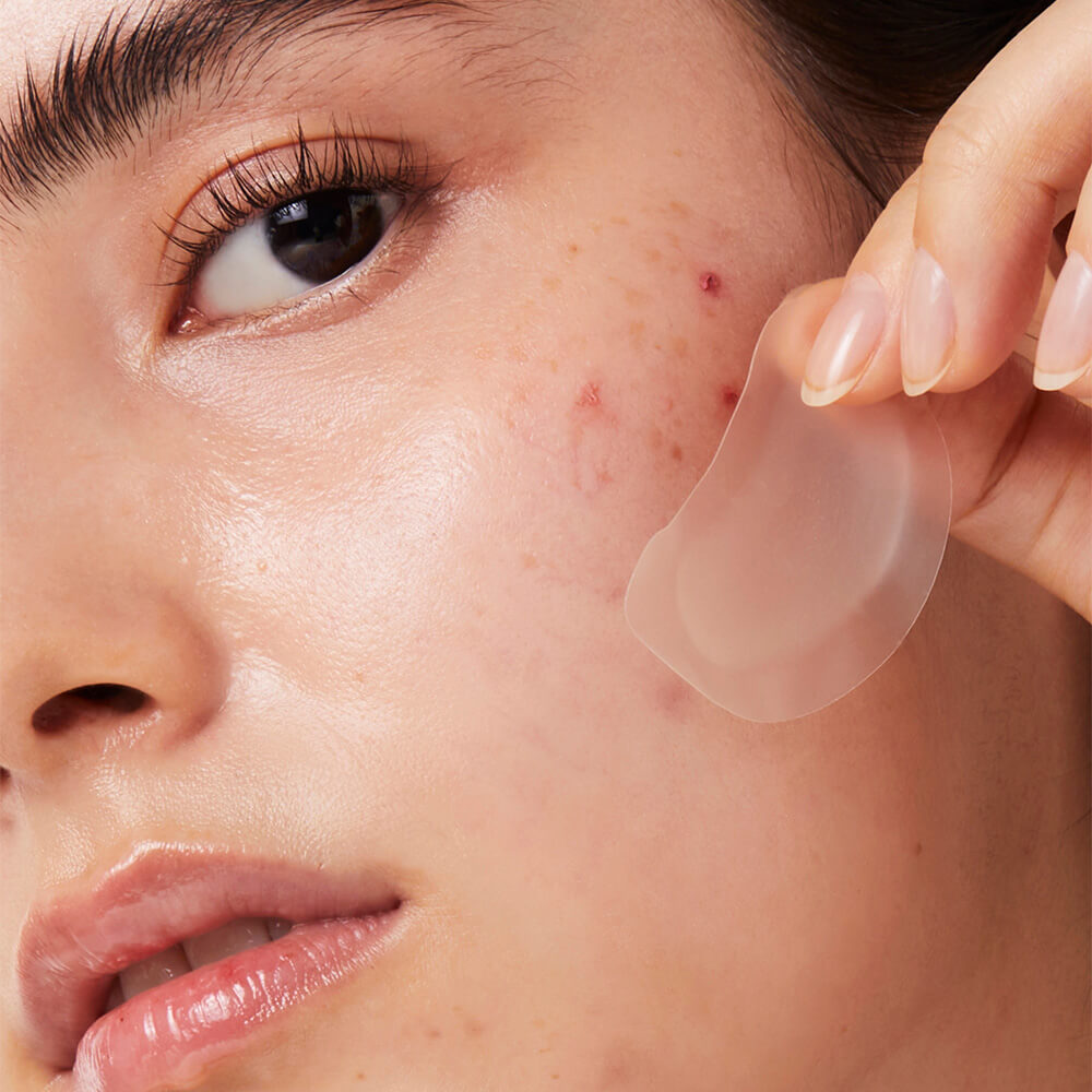 I DEW CARE Timeout Blemish Patch Chin & Cheeks | Hydrocolloid Spot ...