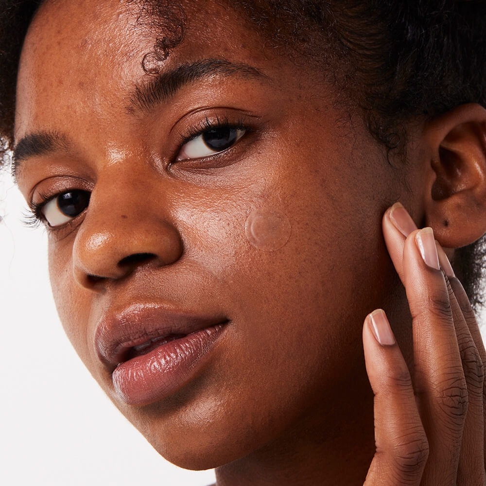 I DEW CARE Timeout Blemish Patch Dark Spot | Hydrocolloid Spot Treatment